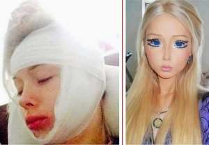 Human Barbie Valeria Lukyanova beaten up by 'haters'