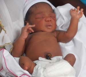 Legless Baby Born In Accra
