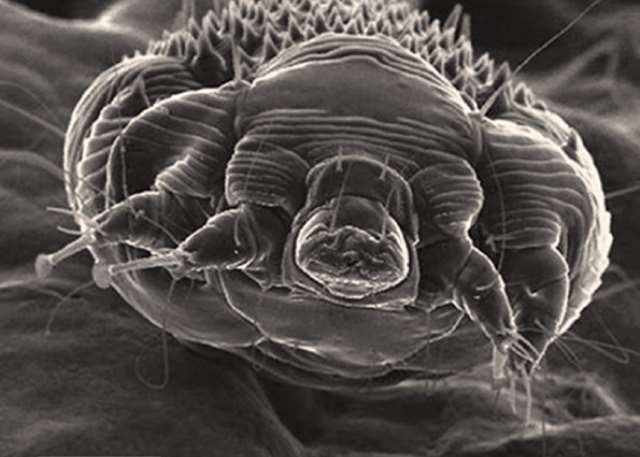 Scabies Mite Microscope