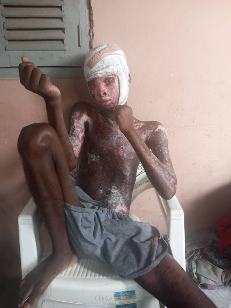 House help faces Court for allegedly pouring acid on SHS graduate