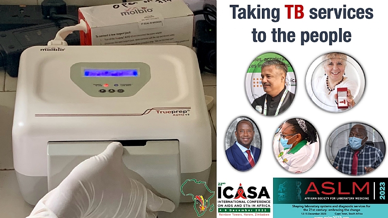 Taking TB services closer to the people in Africa is pivotal to stop TB
