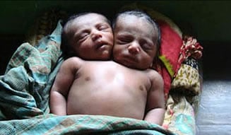 Two-headed baby under guard