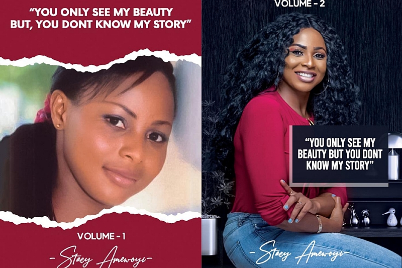 You Only See My Beauty But You Don’t Know My Story