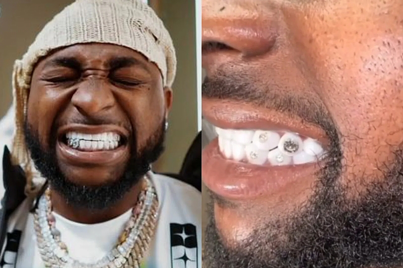 Davido flaunts $2 Million chain and $500,000 diamond teeth in viral video