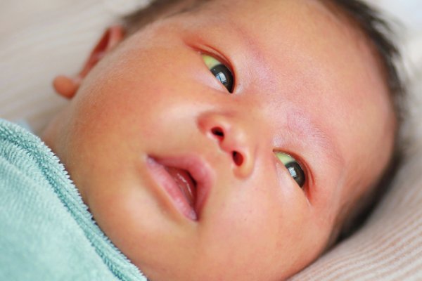 Don't expose babies' eyes to sunlight—Optometric to mothers