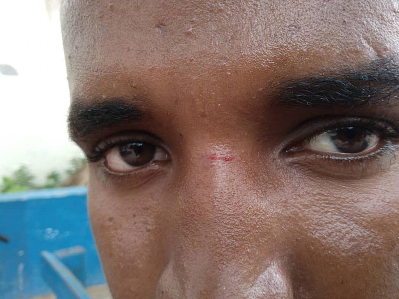 Police violence and incommunicado detention against independent journalists