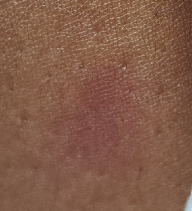 Strange biting insects invade Dawhenya North