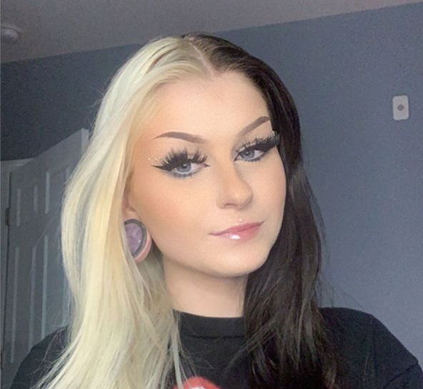 Woman With Two Sex Organs Speaks About Her Ordeal