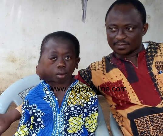 How does it feel to live with a swollen head for 10yrs? - The story of ...