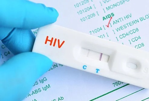 HIV test kits to be available in pharmacies soon – Dr Ayisi Addo