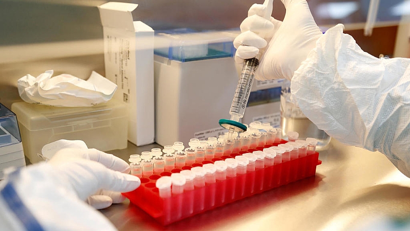 Thousands test positive for brucellosis after China lab leaks bacterial ...