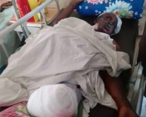 Another victim of Appiatse explosion dies on at Okomfo Anokye