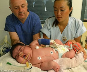 Mother Gives Birth To Giant Baby Girl