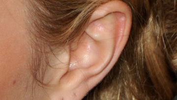 'Fat' woman tries to eat man's ear