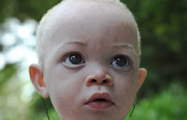 SPELL OF THE ALBINO