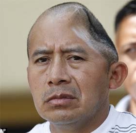 Brain damaged man awarded $58million after bouncer smashed his head so ...