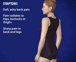 'The Failed Back-Syndrome'