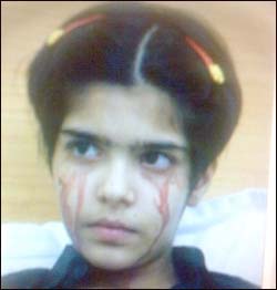 Indian Girl Cries Tears Of Blood