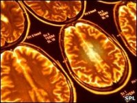 Brain scans being misused as lie detectors