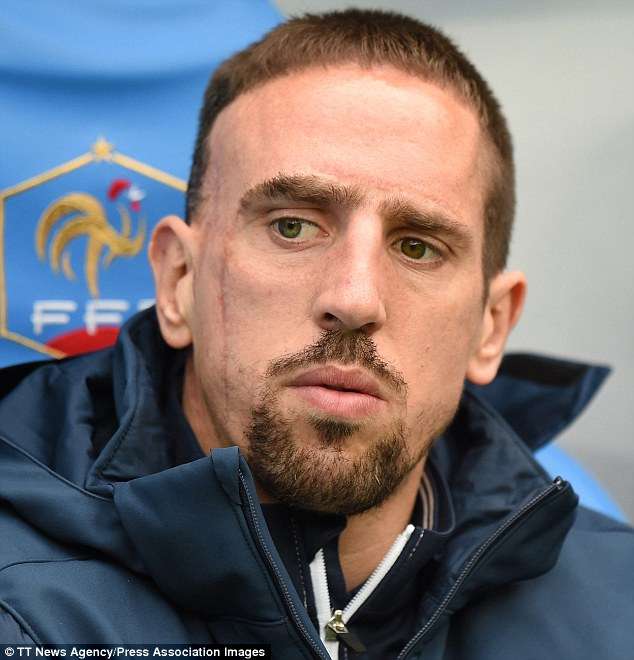 Stricken star: Back injury troubles Ribery’s World Cup hope