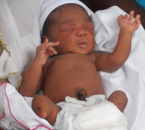 Legless Baby Born In Accra