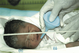 Finney Hospital Delivers First In Vitro Baby