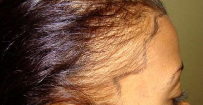 Grow Your Hair Line For The Perfect Look