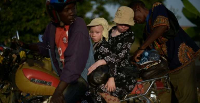 An island refuge for Tanzania's albino people