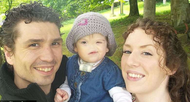 Meet Cheerful 17-Months-Old Baby Girl Born Without A Nose