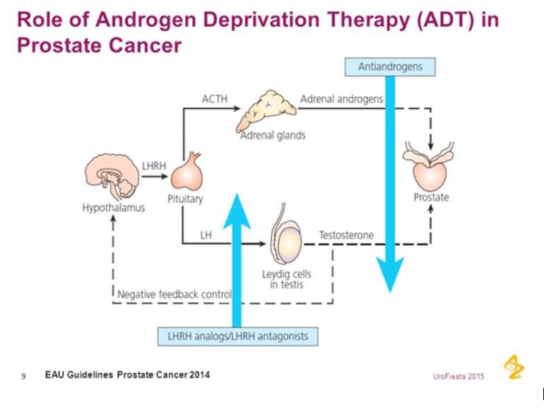ADT, Apalutamide and Exercise in the Treatment of Prostate Cancer